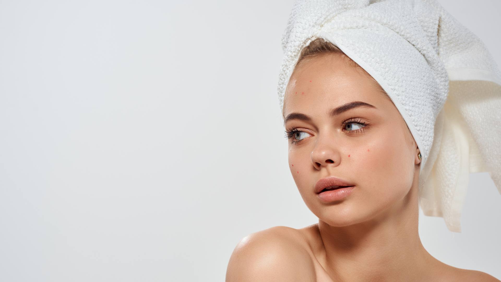 Discover the underlying causes of acne and take control of your skin ...